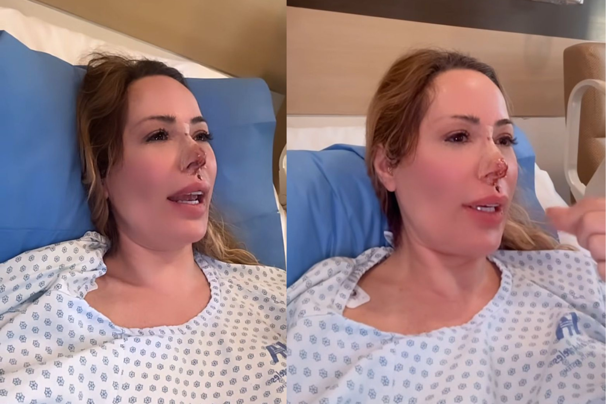 Influenciadora Ju Isen tem parte do nariz arrancada por um cachorro e passa por cirurgia de ...