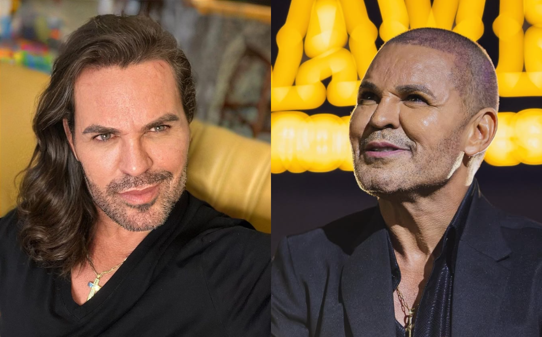 Hoje careca, Eduardo Costa já teve cabelão e 25kg a mais; veja o antes ...