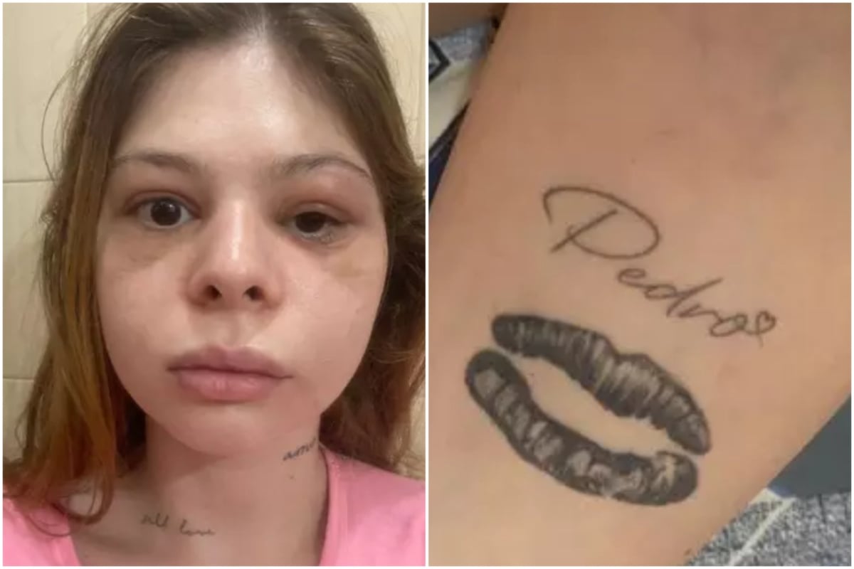 Médica espancada por fisiculturista muda tatuagens feitas como 'prova de amor' para ele | Jornal ...